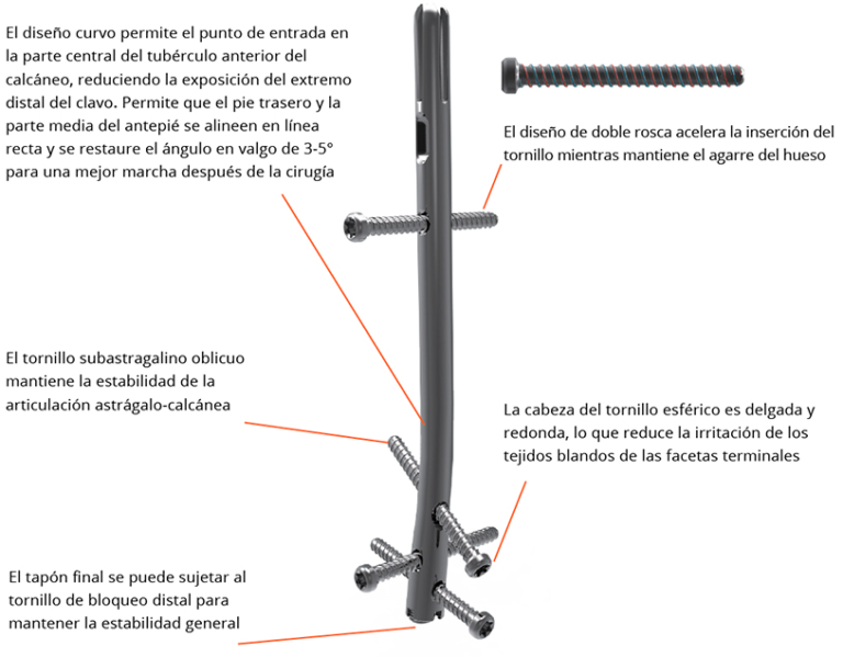Clavo RAMIC de Artrodesis de Tobillo - Bioadvance